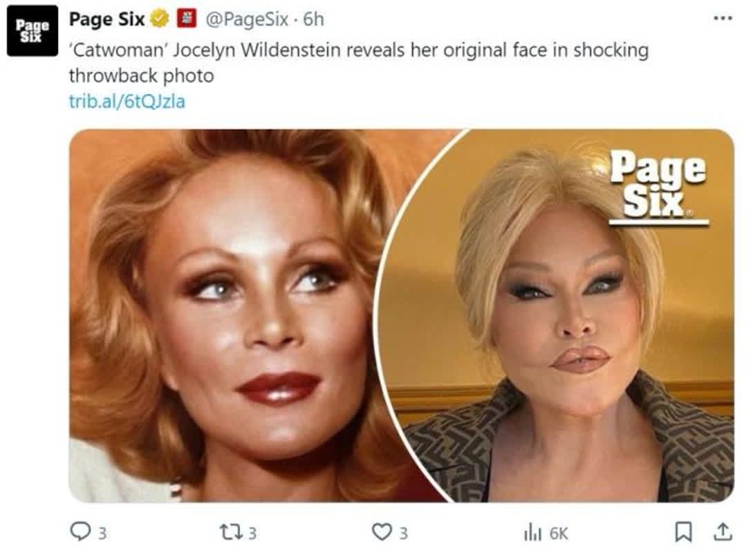 'Catwoman' Jocelyn Wildenstein's Face Transformation: A Look Back at ...