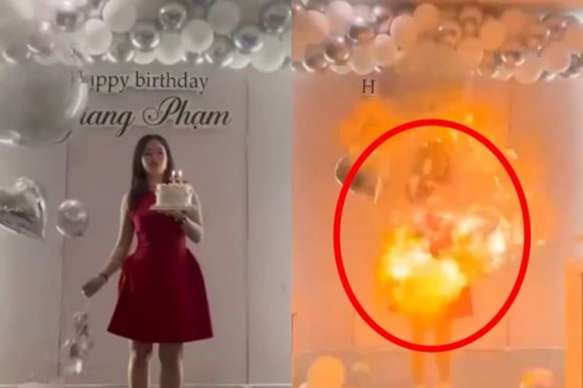 Balloon Explosion at Birthday Party Leaves Woman With Second-Degree Burns